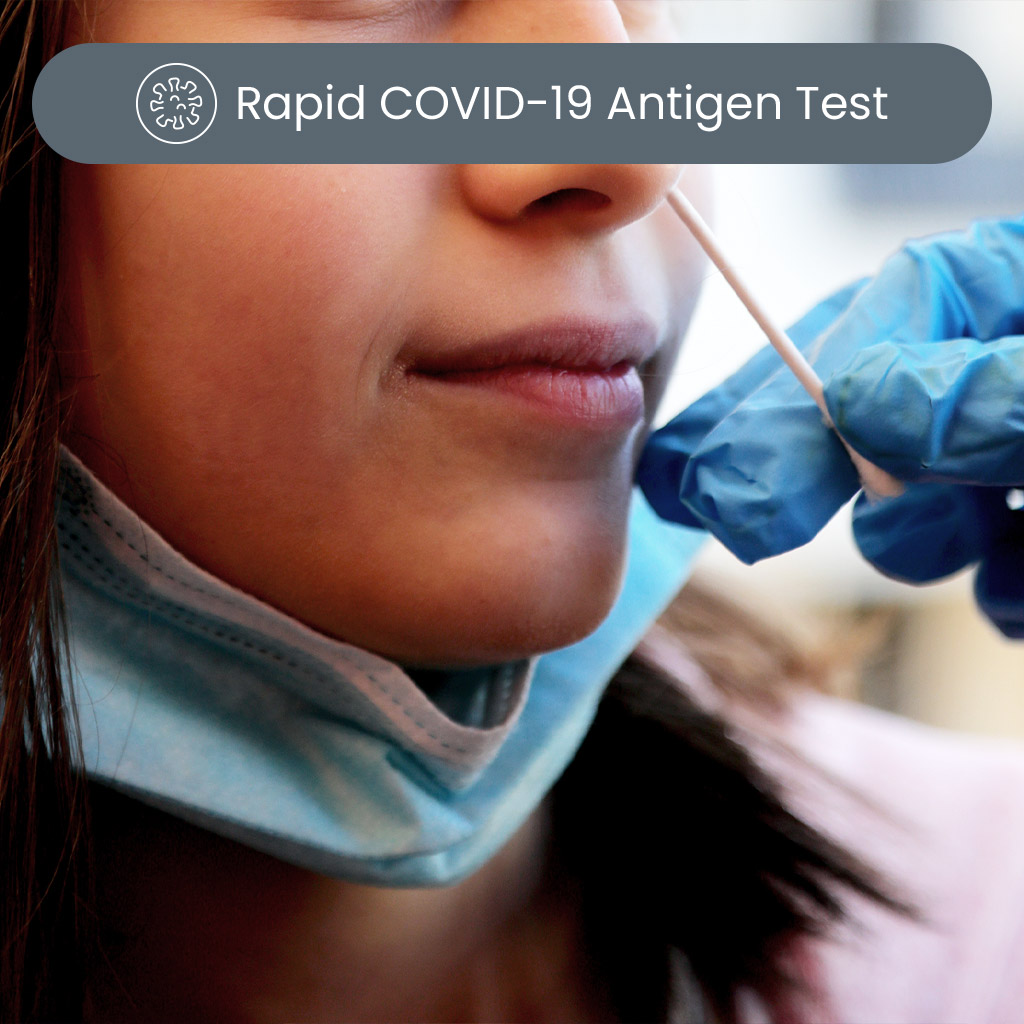 Rapid COVID-19 Antigen Test | My Labs Direct