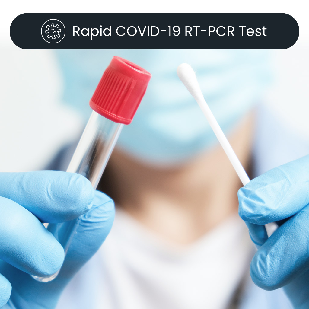 Rapid COVID-19 RT-PCR Test | My Labs Direct