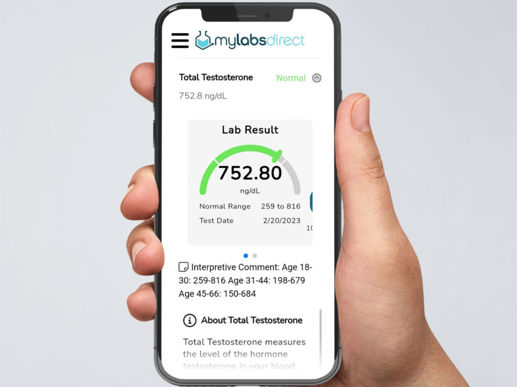 Men's Complete Hormone Test Kit | My Labs Direct